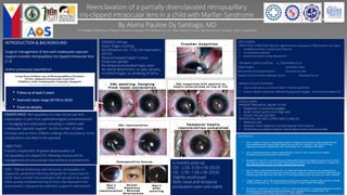E-poster on Reenclavation of a partially disenclavated retropupillary ...