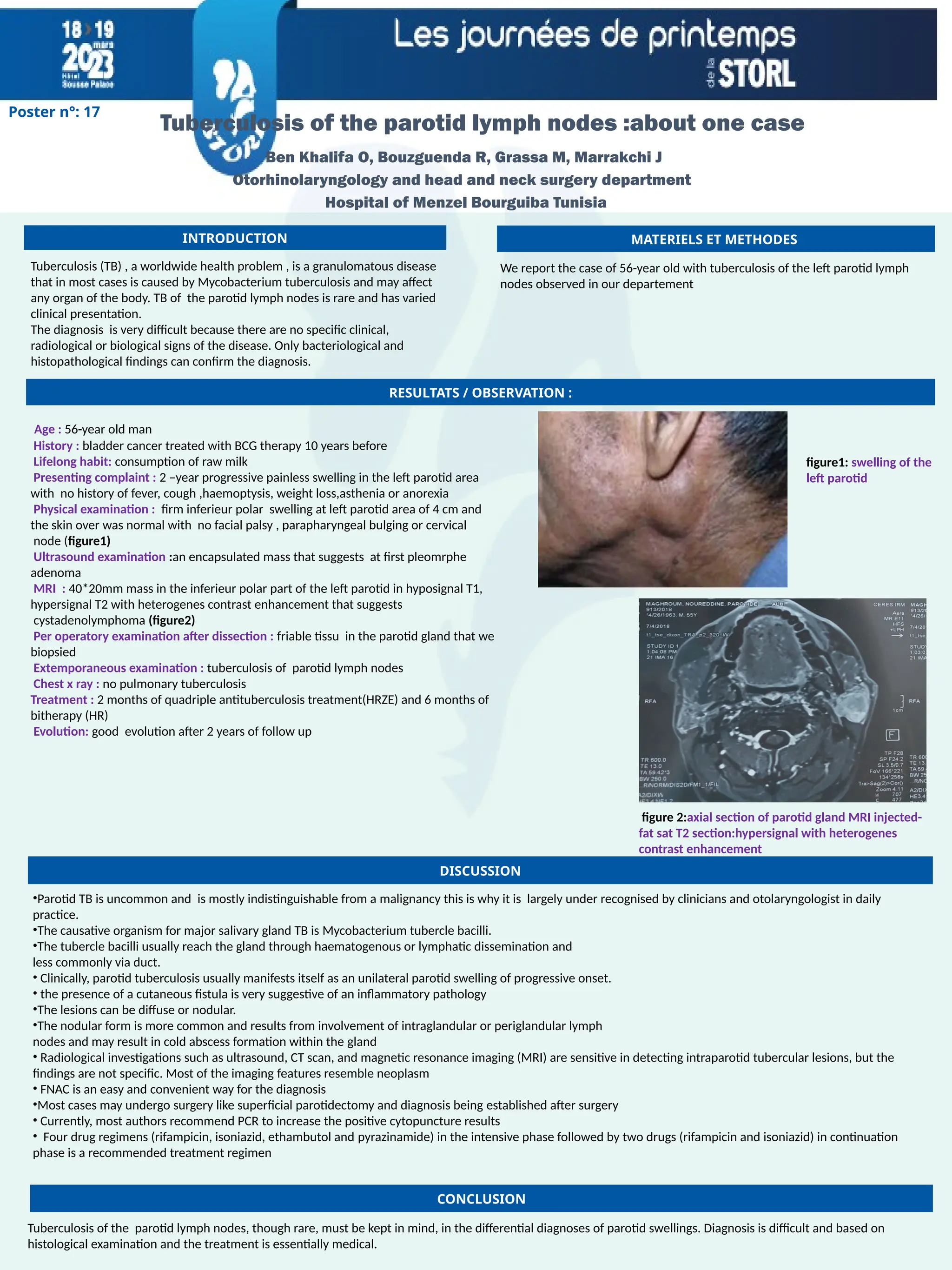 e poster tbc parotidienne .pptx