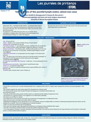 e poster tbc parotidienne .pptx