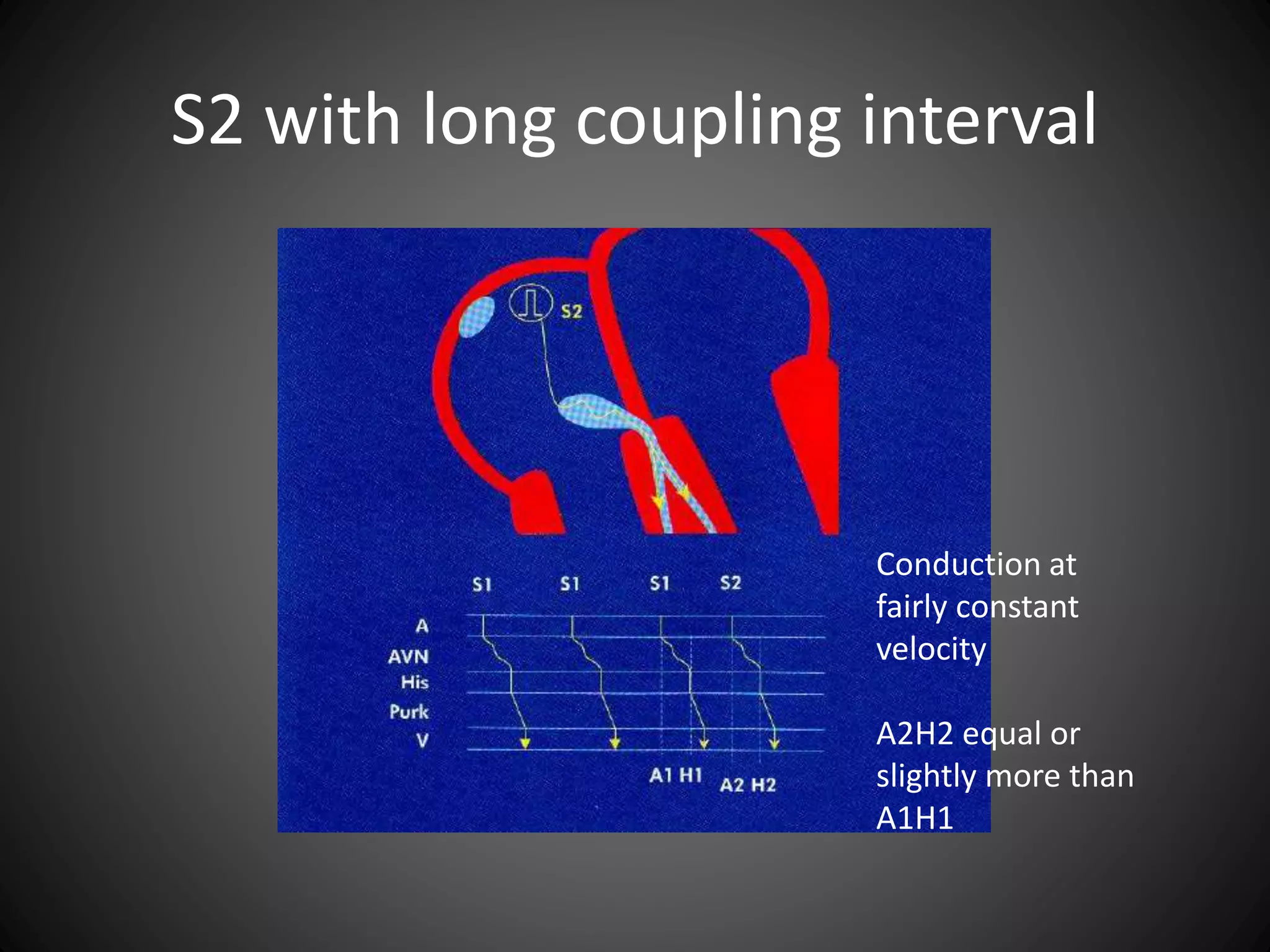 Electrophysiology study protocol | PPTX