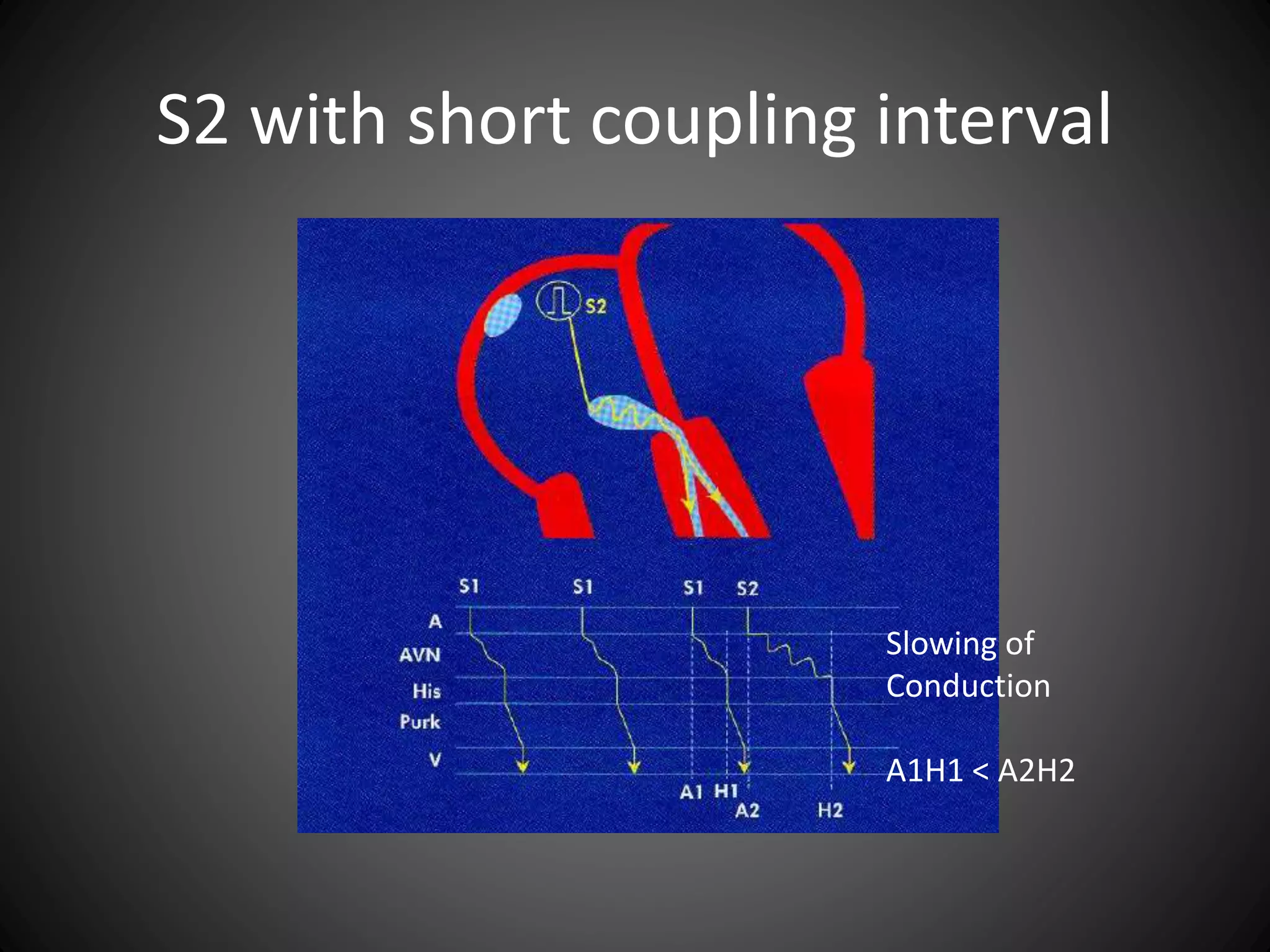 Electrophysiology study protocol | PPTX