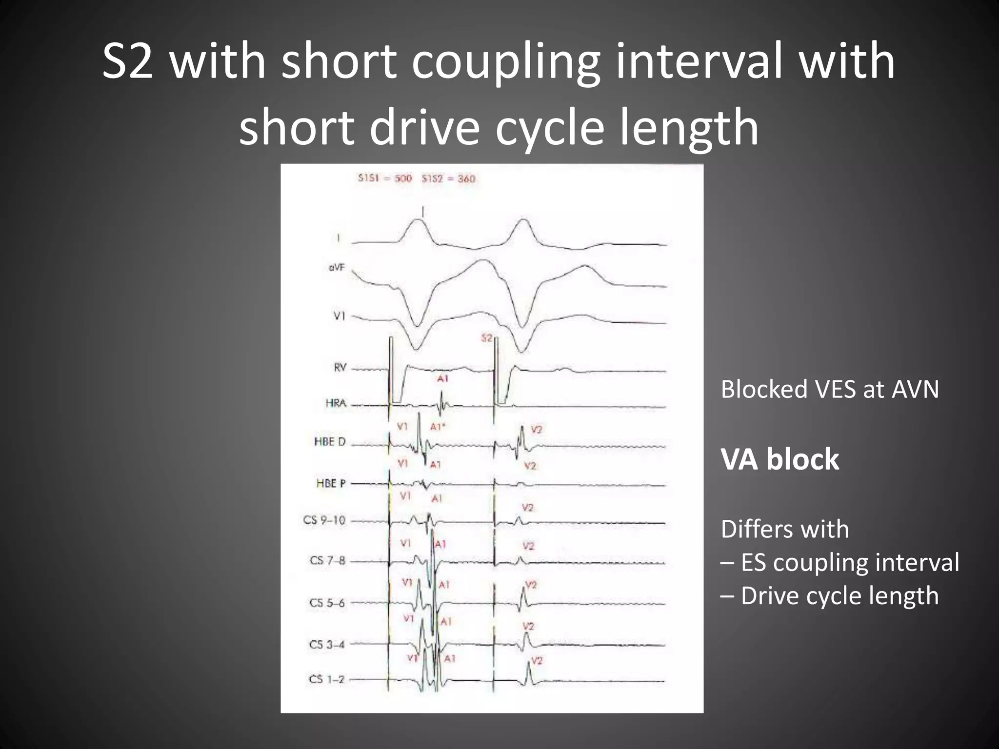 Electrophysiology study protocol | PPTX