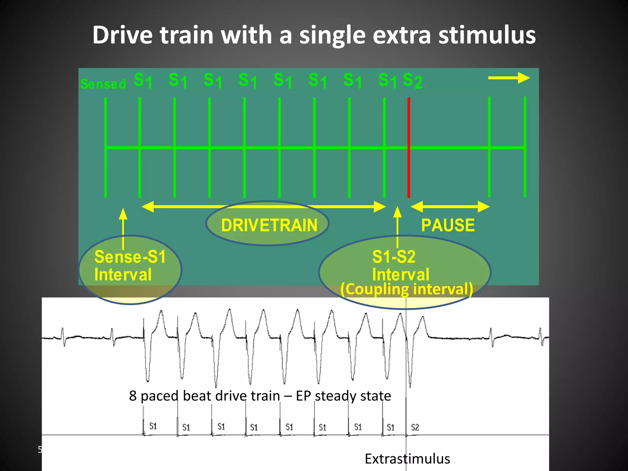 Electrophysiology study protocol | PPTX