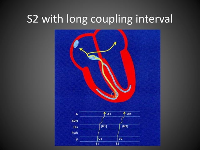 Electrophysiology study protocol | PPTX | Heart and Cardiovascular ...