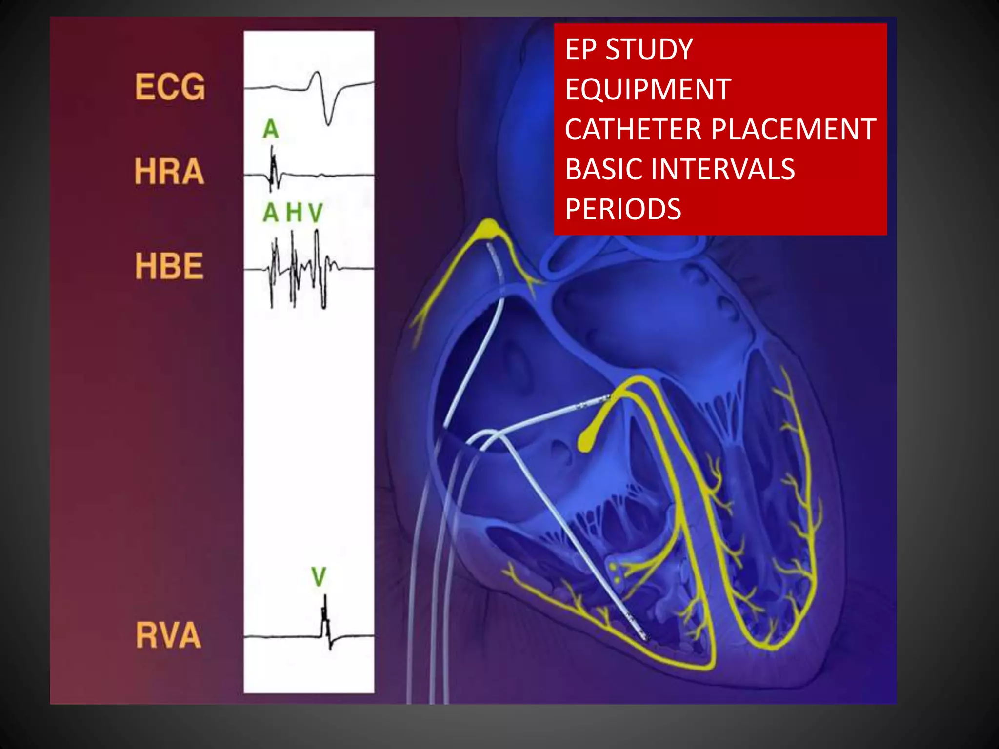 Electrophysiology study basics | PPTX
