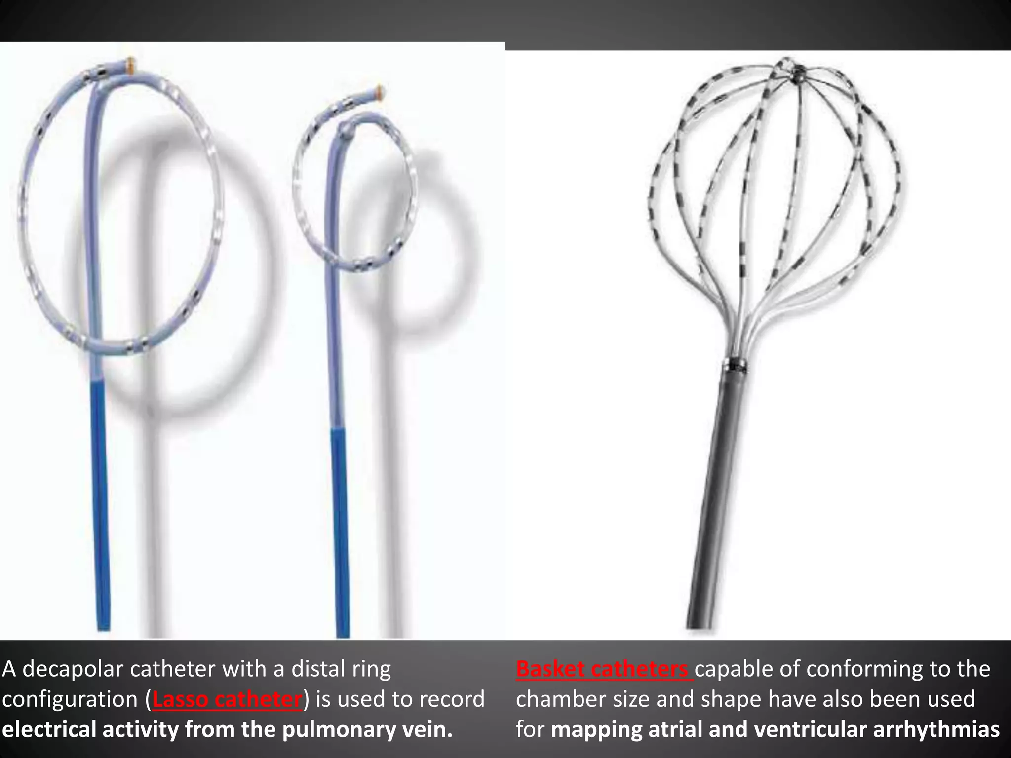 Electrophysiology study basics | PPTX