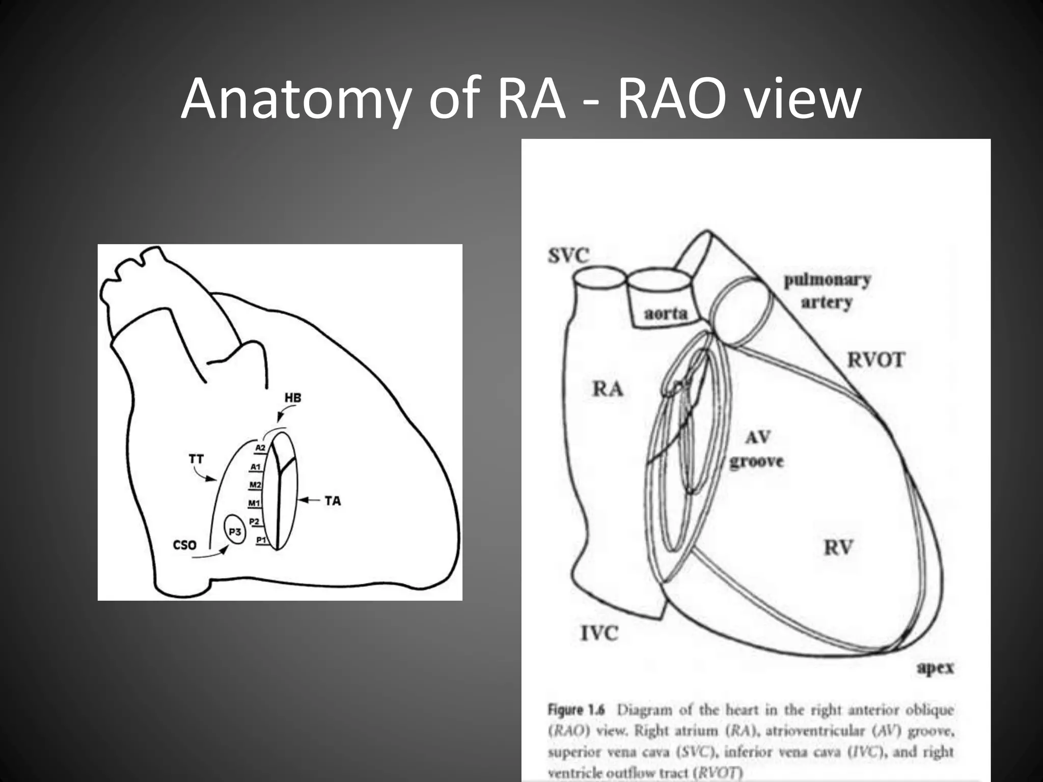Electrophysiology study basics | PPTX