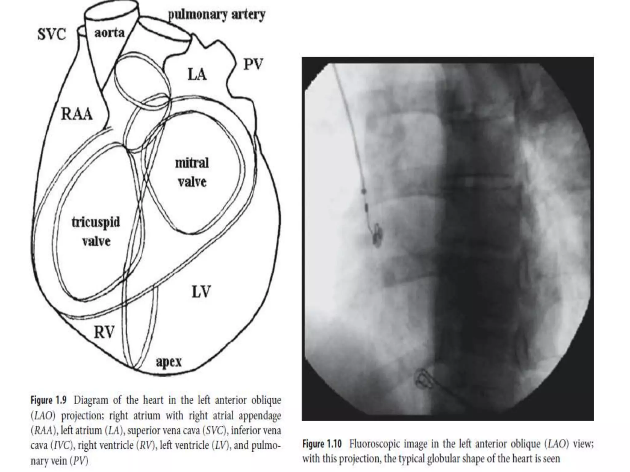 Electrophysiology study basics | PPTX