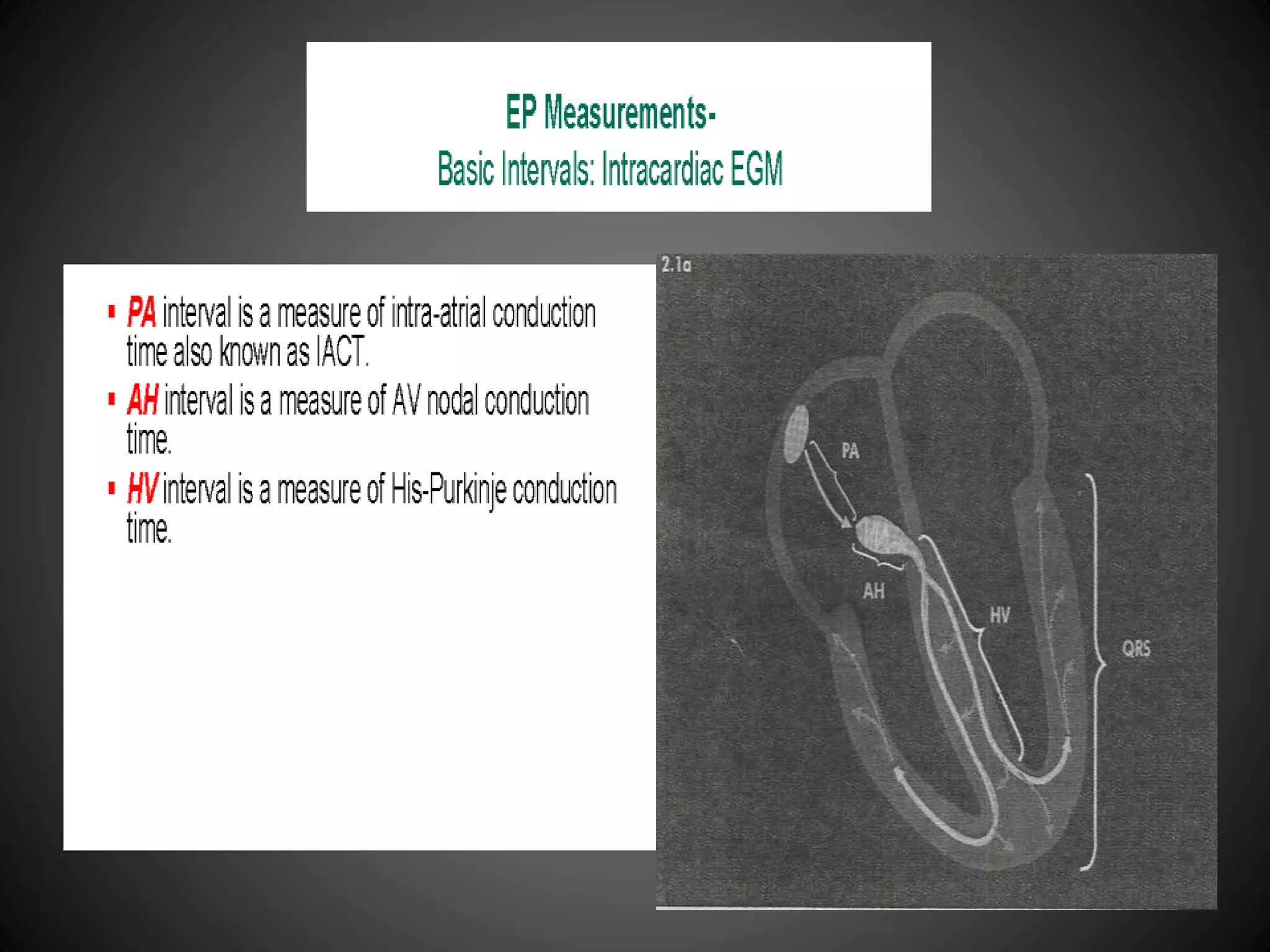 Electrophysiology study basics | PPTX