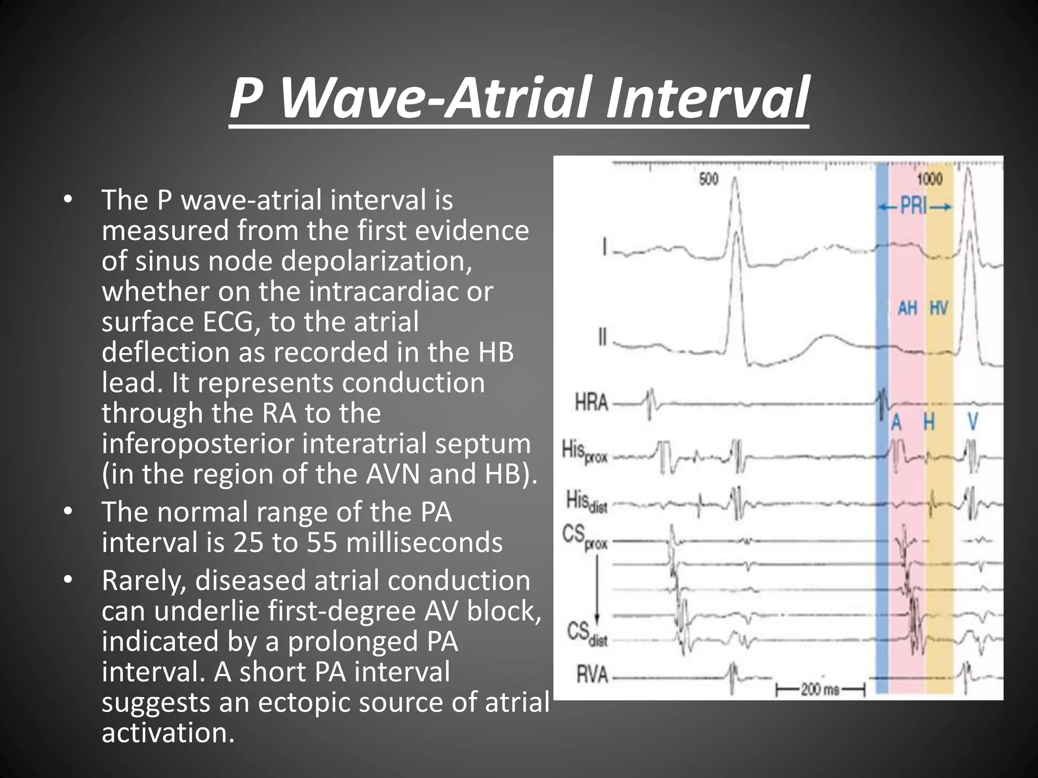 Electrophysiology study basics | PPTX