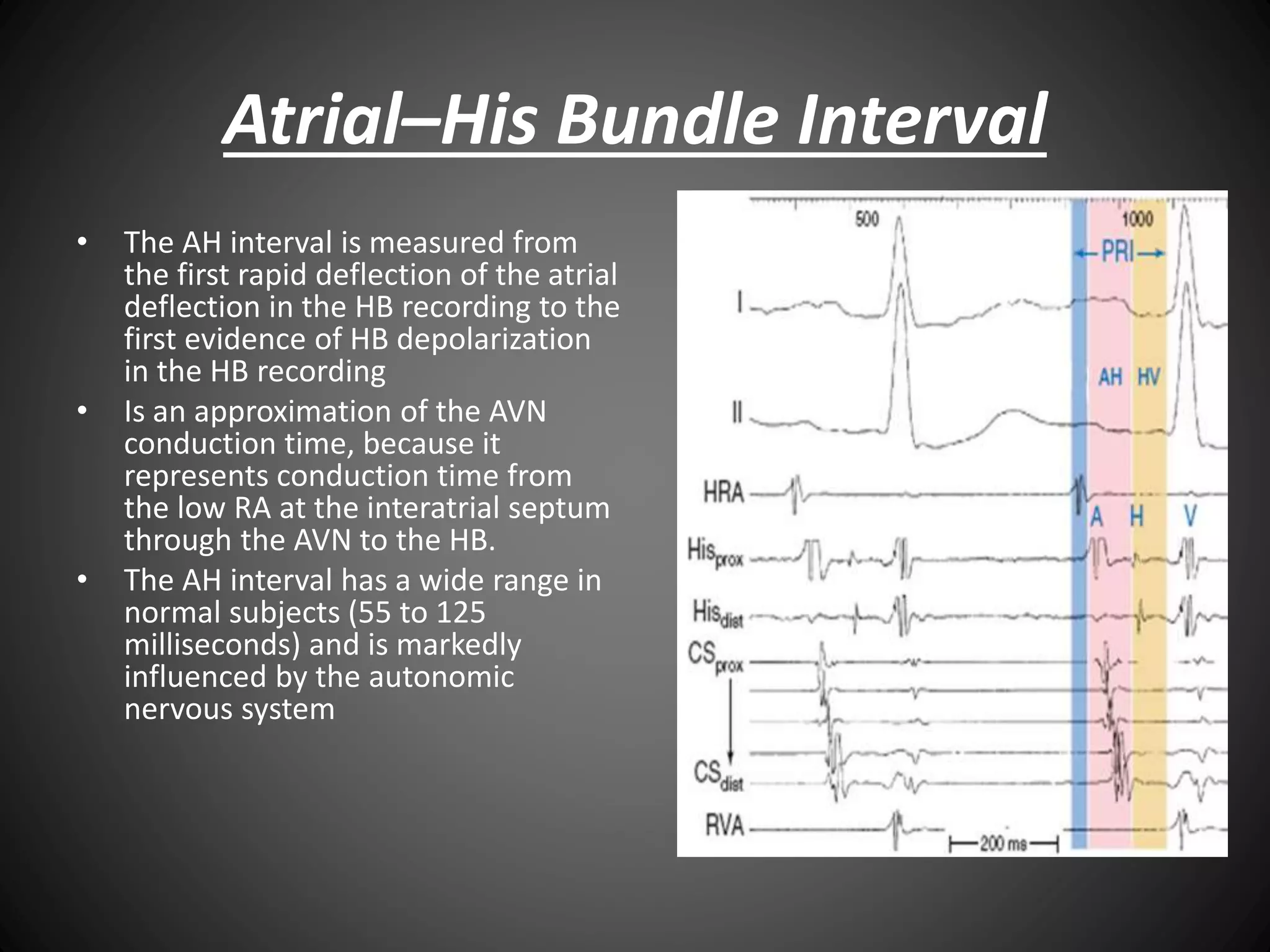 Electrophysiology study basics | PPTX