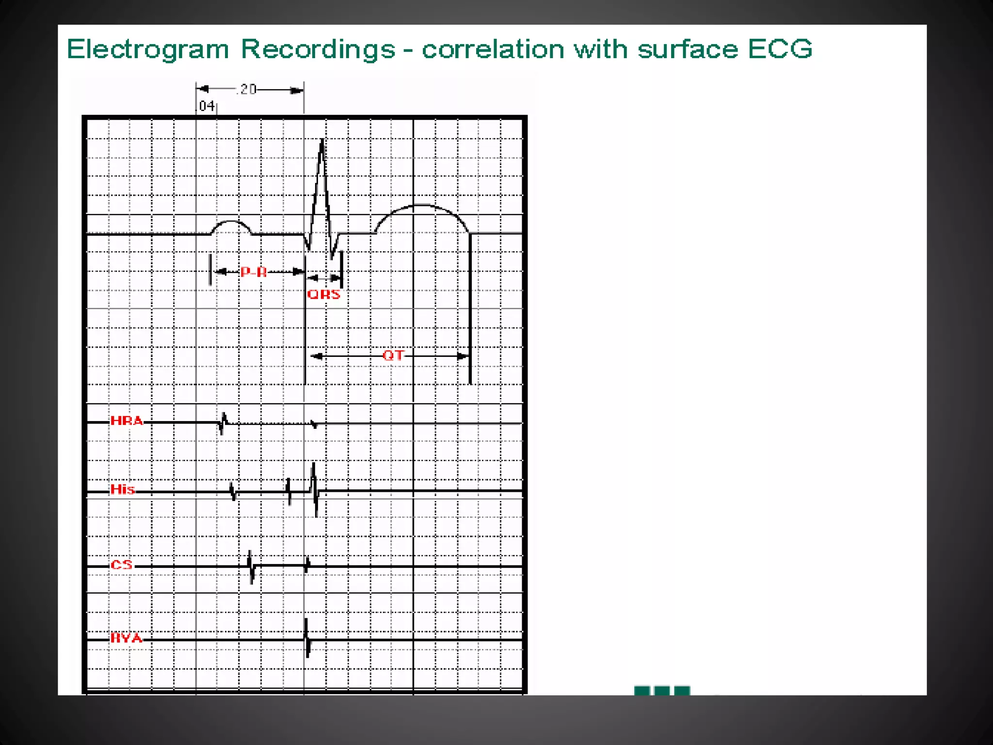 Electrophysiology study basics | PPTX