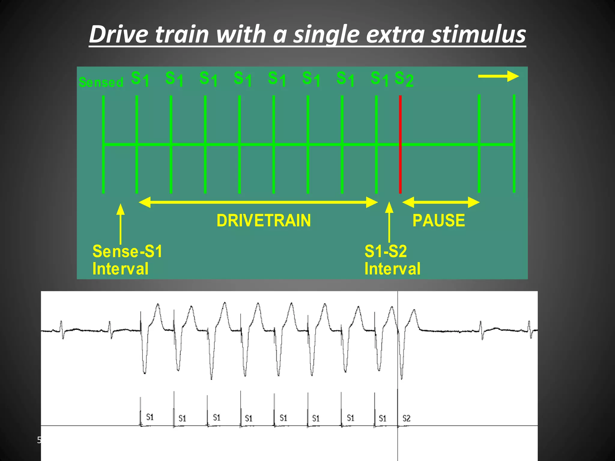 Electrophysiology study basics | PPTX