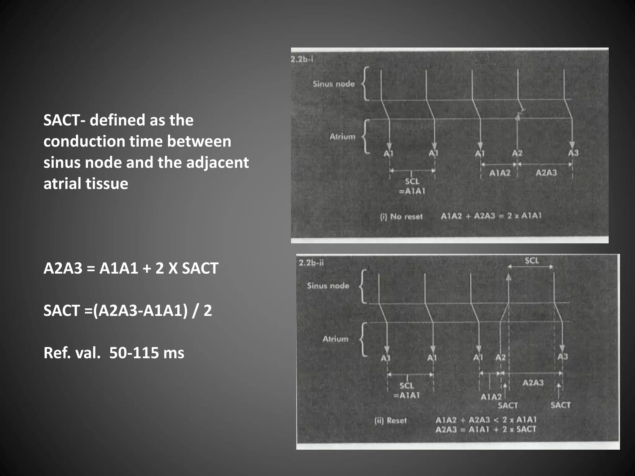 Electrophysiology study basics | PPTX