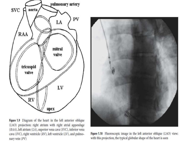Electrophysiology study basics | PPTX
