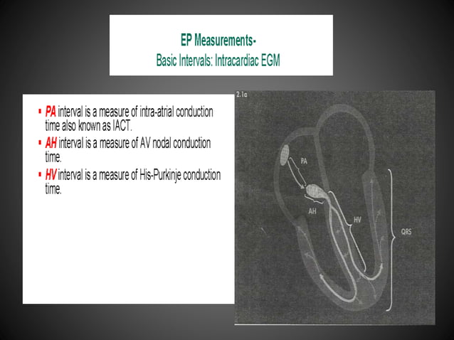 Electrophysiology study basics | PPTX