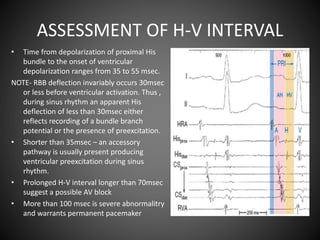 Electrophysiology study basics | PPTX