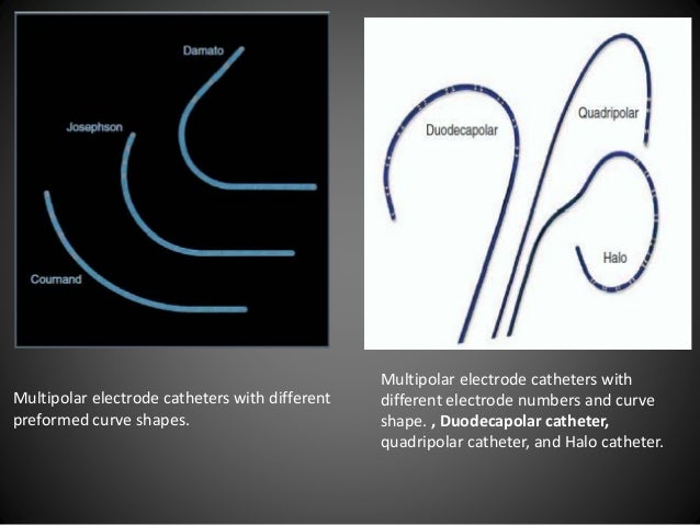 Electrophysiology study basics