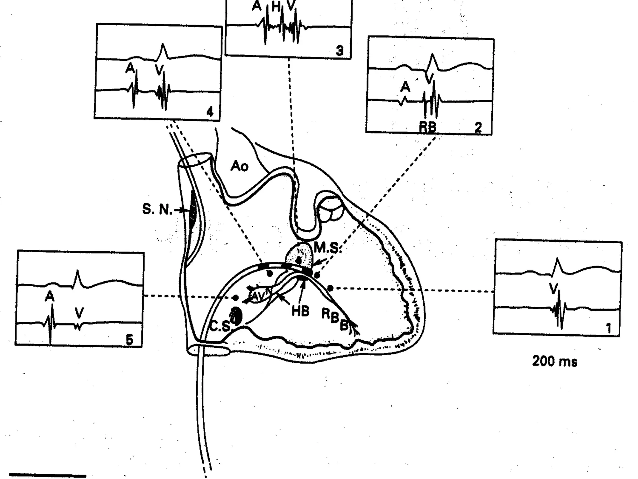 Electrophysiology basics,part1(lecture) | PPT
