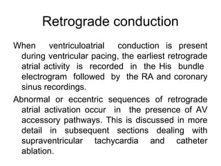 Eps basics,part2(lecture) | PPT