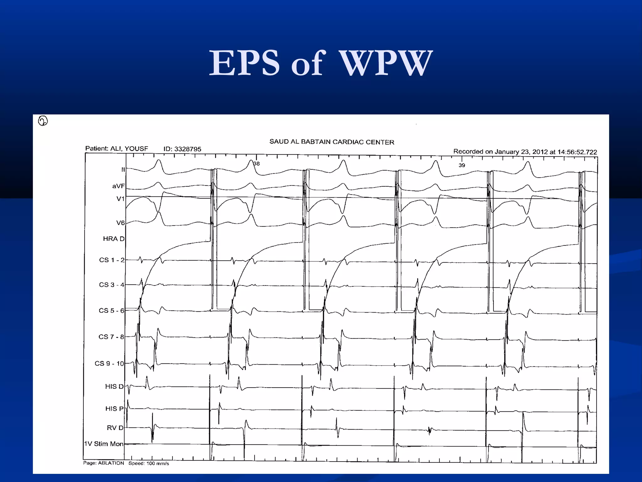 ELectrophysiology basics part4 | PPT