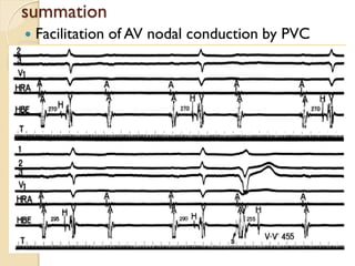 Electrophysiologic phenomena of the Heart | PDF