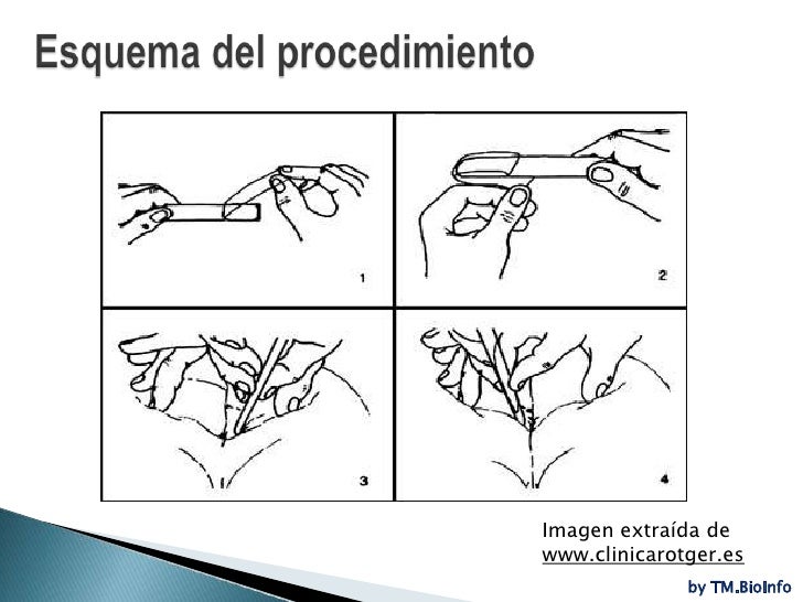Epsd y test de graham