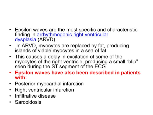 EPSILON WAVE IN ECG AND ITS INTERPRETATION | PPT EPSILON WAVE IN ECG AND ITS INTERPRETATION | PPT