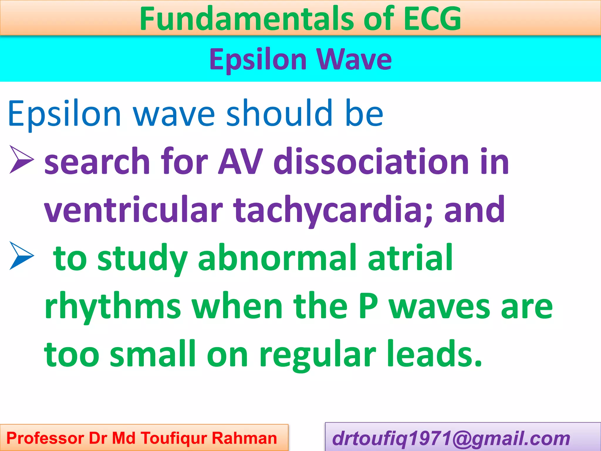 Epsilon wave in ECG | PPSX