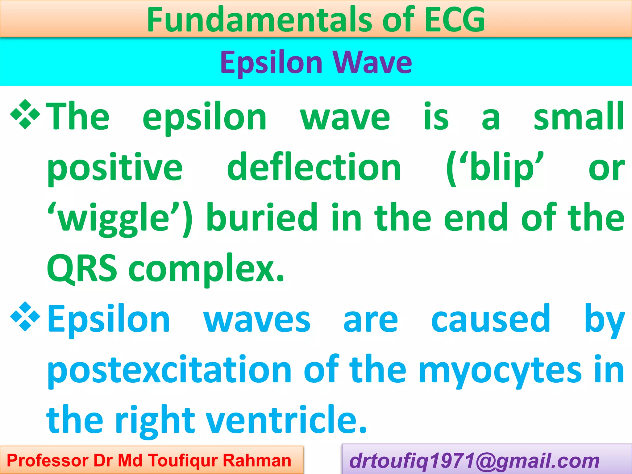 Epsilon wave in ECG | PPSX