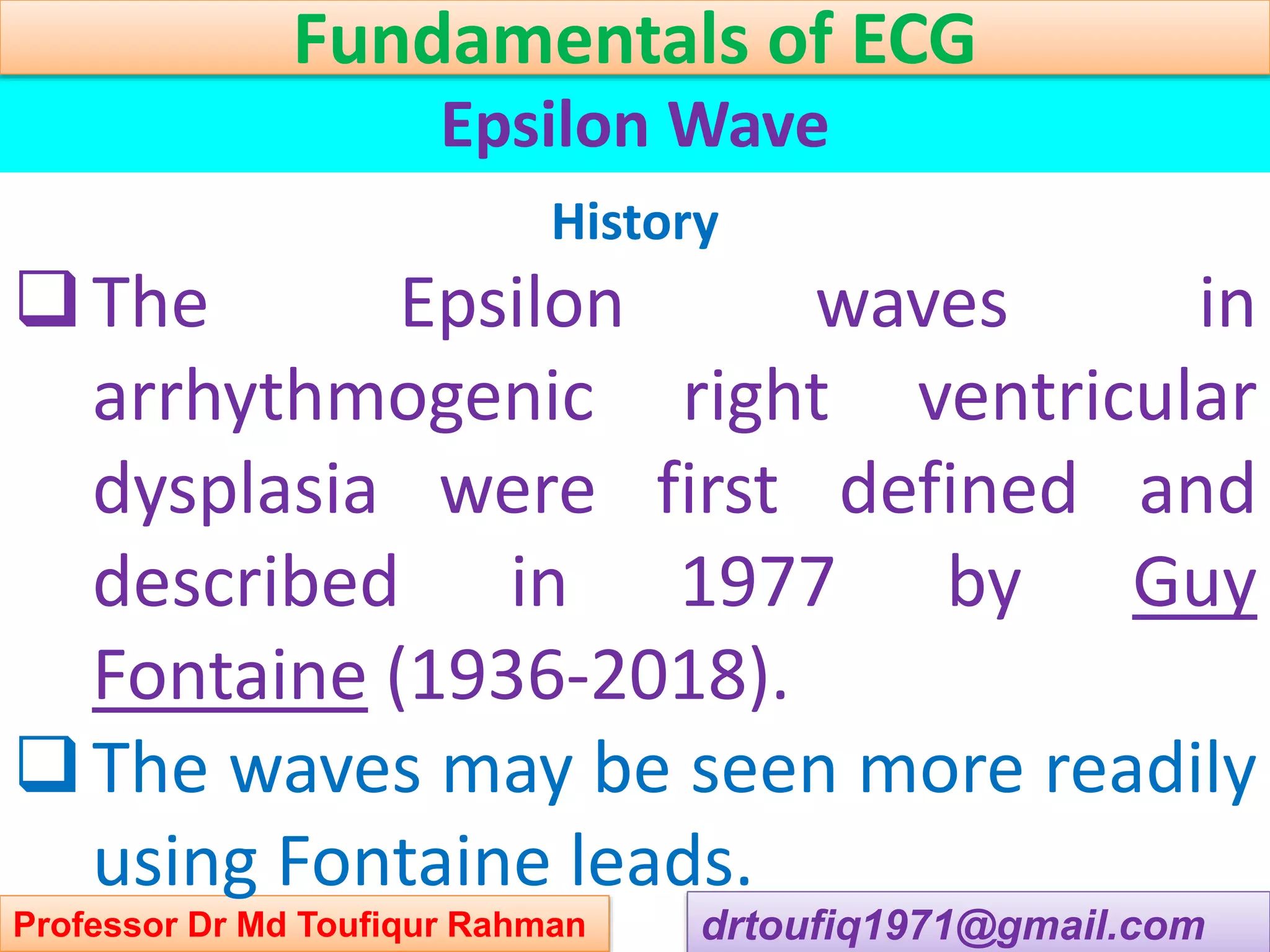Epsilon wave in ECG | PPSX