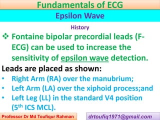 Epsilon wave in ECG | PPSX