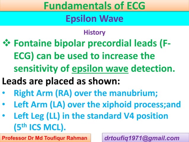 Epsilon wave in ECG | PPSX | Heart and Cardiovascular Diseases ...