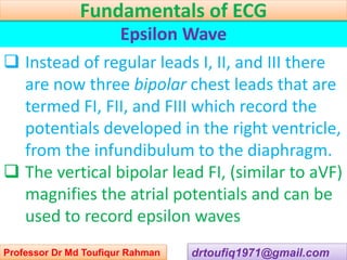 Epsilon wave in ECG | PPSX