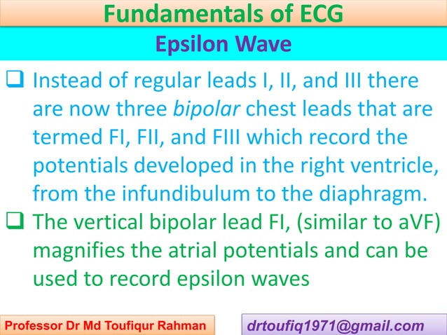 Epsilon wave in ECG | PPSX | Heart and Cardiovascular Diseases ...
