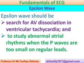 Epsilon wave in ECG | PPSX