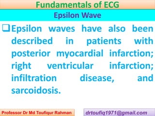 Epsilon wave in ECG | PPSX