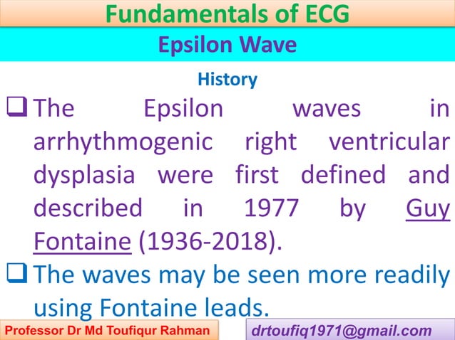 Epsilon wave in ECG | PPSX | Heart and Cardiovascular Diseases ...