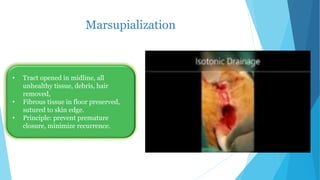 EPSiT study copy Pilonidal sinussss.pptx