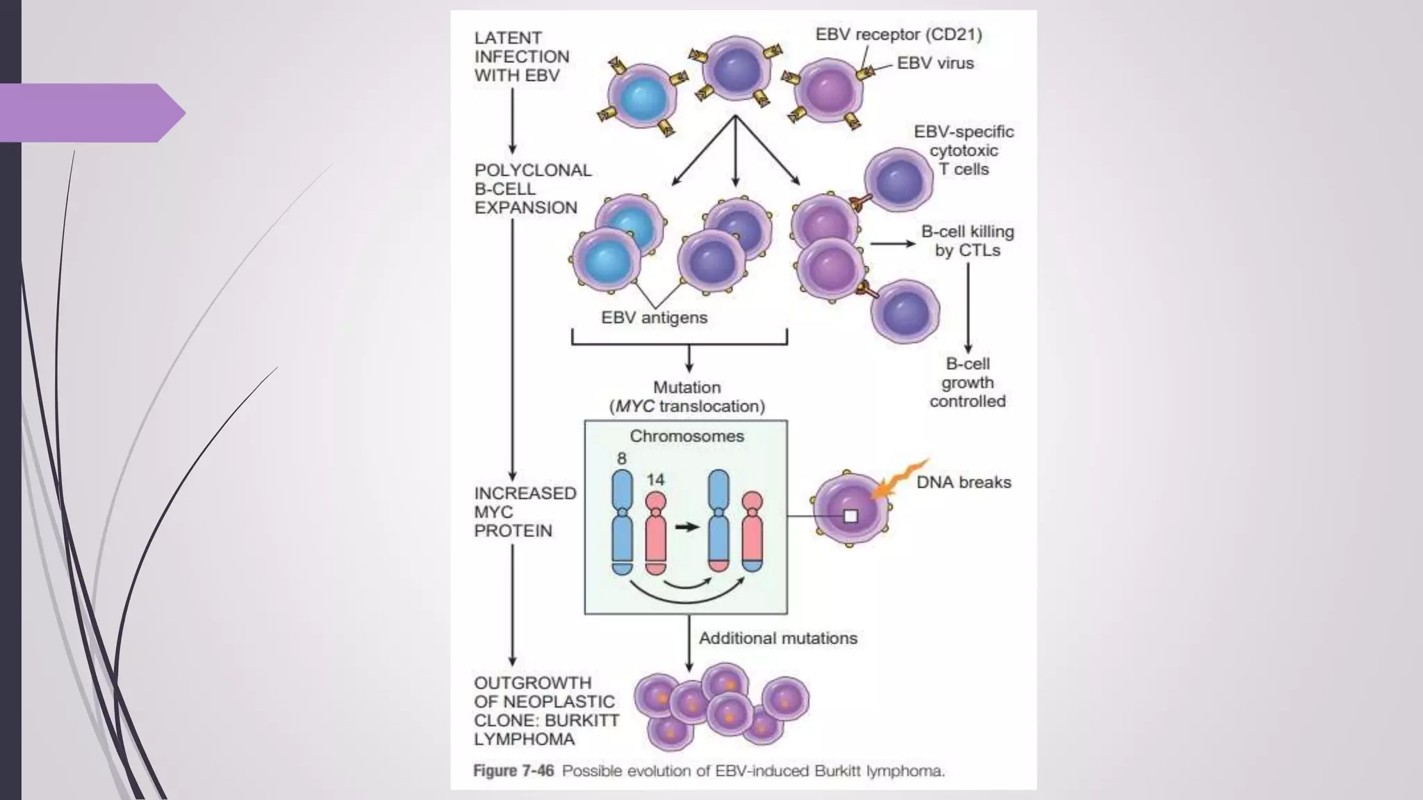 EPSTEIN-BARR VIRUS.pptx