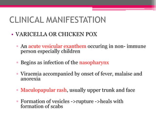 Epstein barr virus (ebv) and varicella | PPTX