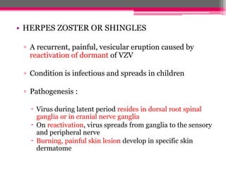 Epstein barr virus (ebv) and varicella | PPTX