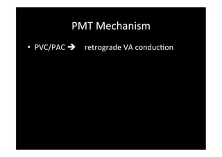 Pacemaker Mediated Tachycardia... or not? | PDF