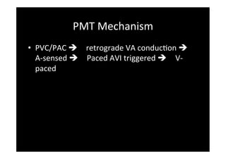 Pacemaker Mediated Tachycardia... or not? | PDF