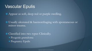 Common Benign Mucosal Swellings of Oral Cavity | PPTX