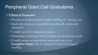 Common Benign Mucosal Swellings of Oral Cavity | PPTX