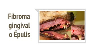 Epulis, mucocele salival y palatitis incisiva | PDF
