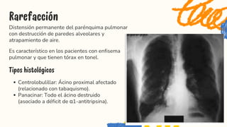 Sindromes pleuropulmonares signos y síntomas. | PDF