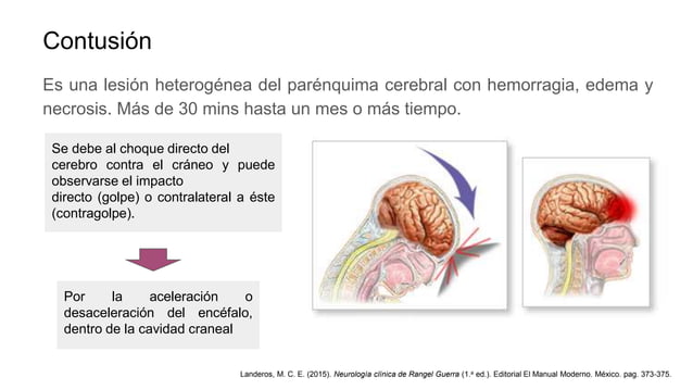 EQ3.TRAUMATISMO CRANEOENCEFALICO_ CONMOCIÓN, CONTUSIÓN, HERIDAS.pptx
