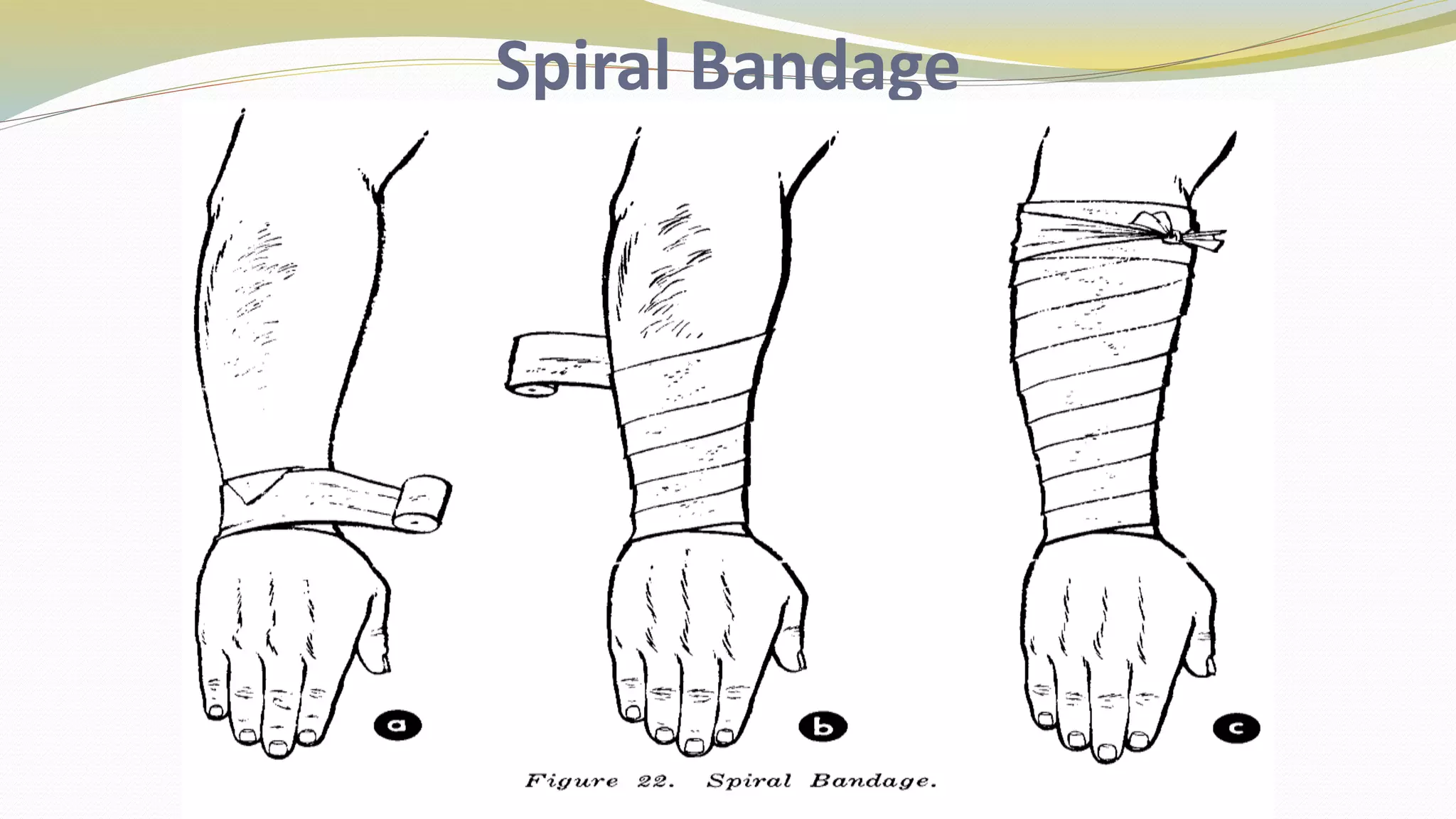 Bandaging.pptx | First Aid | Injuries